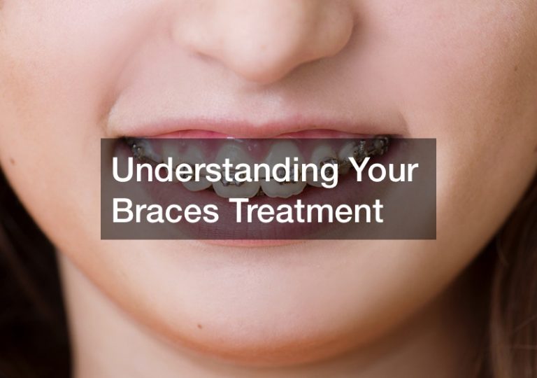 Understanding Your Braces Treatment - Do I Need Braces?