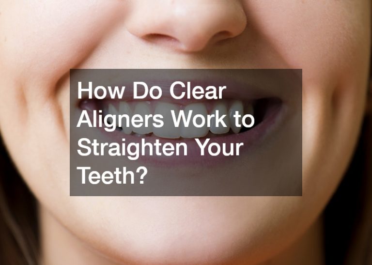 How Do Clear Aligners Work to Straighten Your Teeth? - Do I Need Braces?